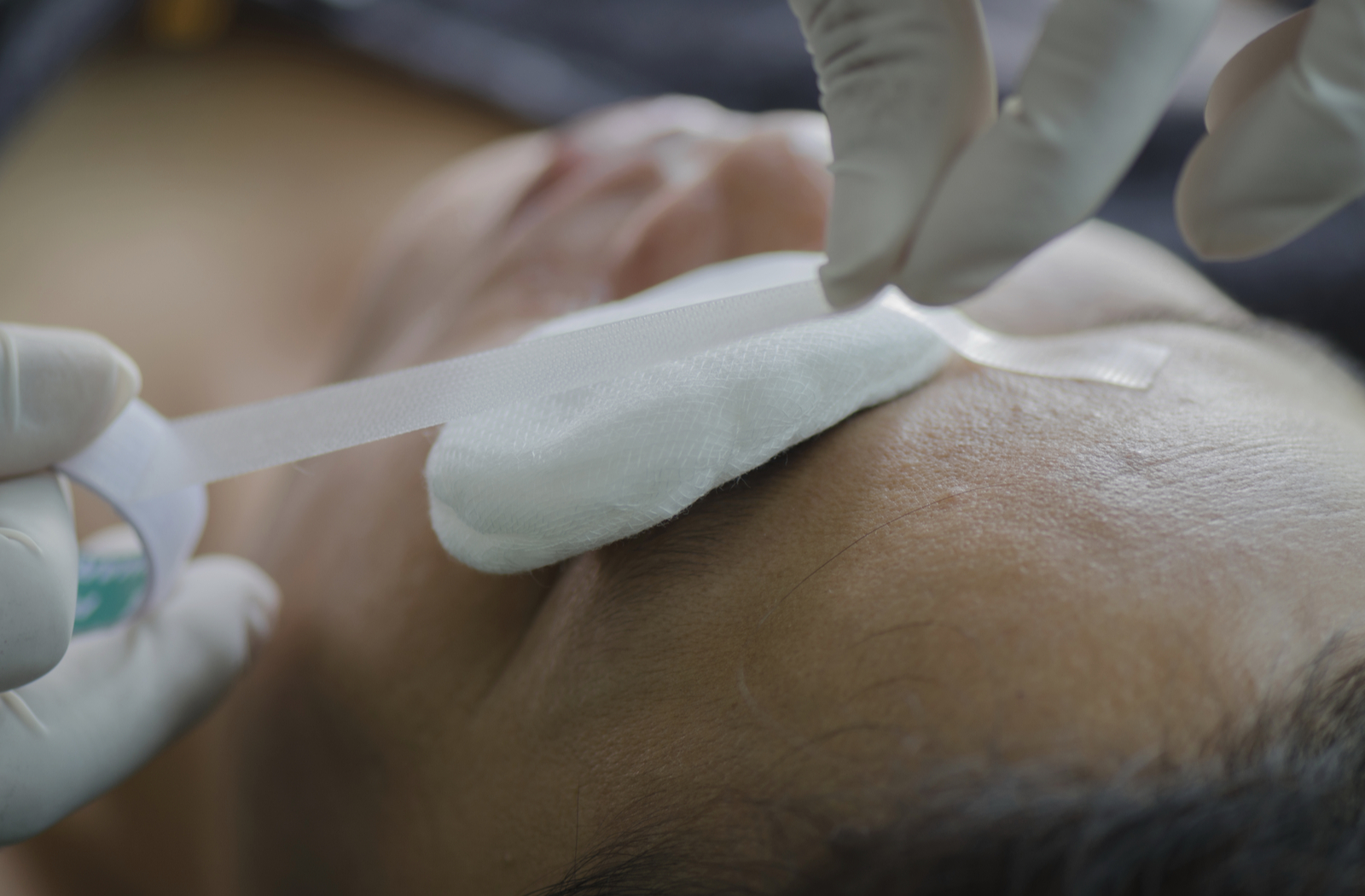 How to Tell if You Are Suffering from an Eye Emergency | ON